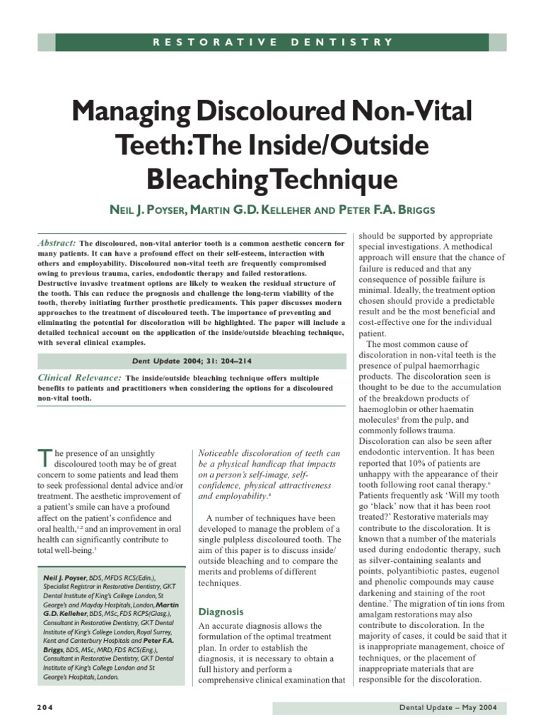 Managing Discoloured Non-Vital Teeth: The Inside/Outside Bleaching ...