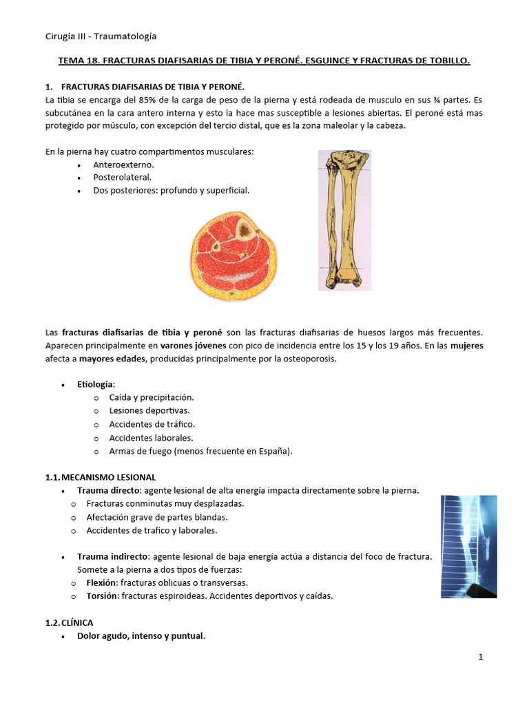 Tema 18. FX Diafisarias de Tibia y Peroné. Esguince y FX de Tobillo | PDF | Tobillo | Rodilla