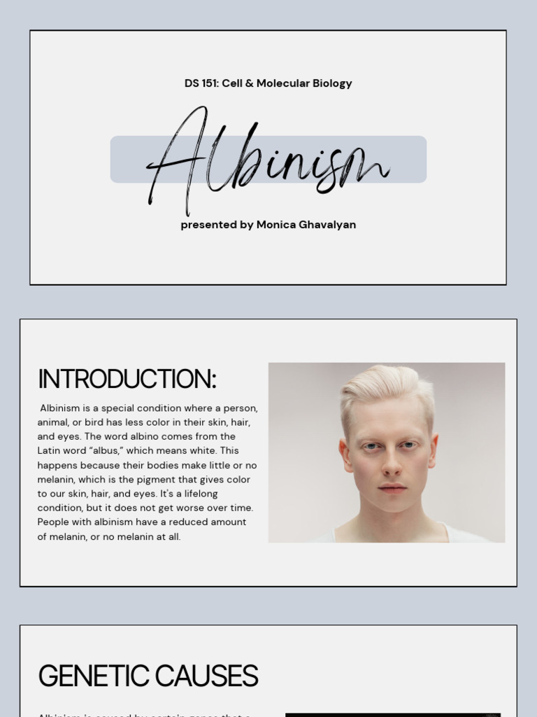 Albinism | PDF | Clinical Medicine | Medical Specialties