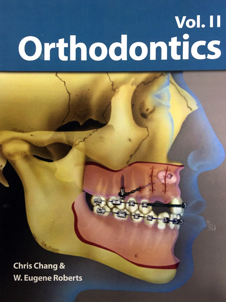 Chris Chang - Orthodontics Vol II | PDF