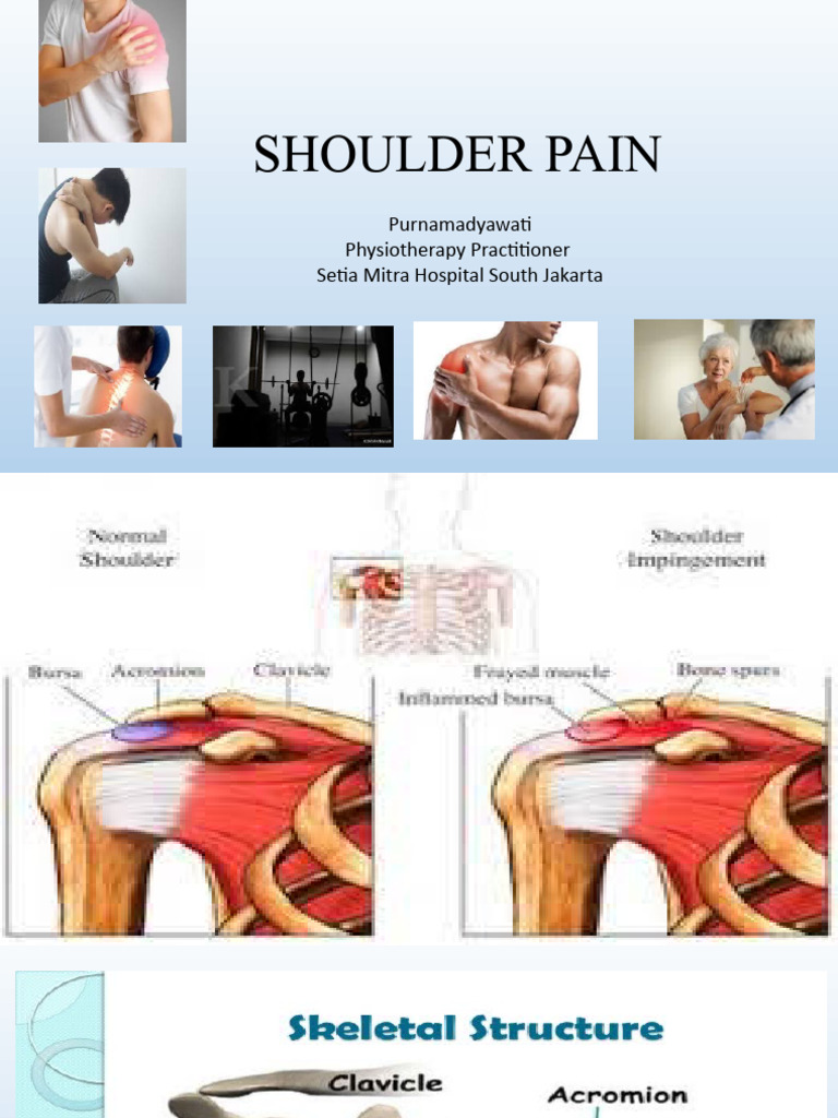Shoulder Pain | PDF