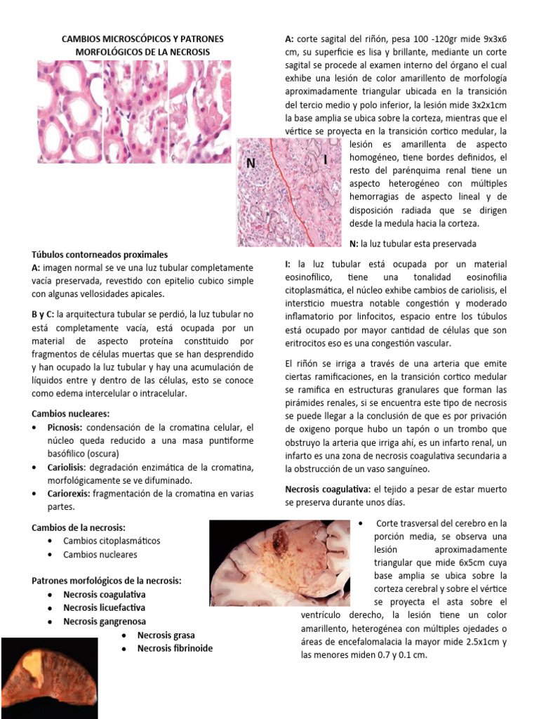 12 Clase - Necrosis | PDF | Mitocondria | Radical (Química)