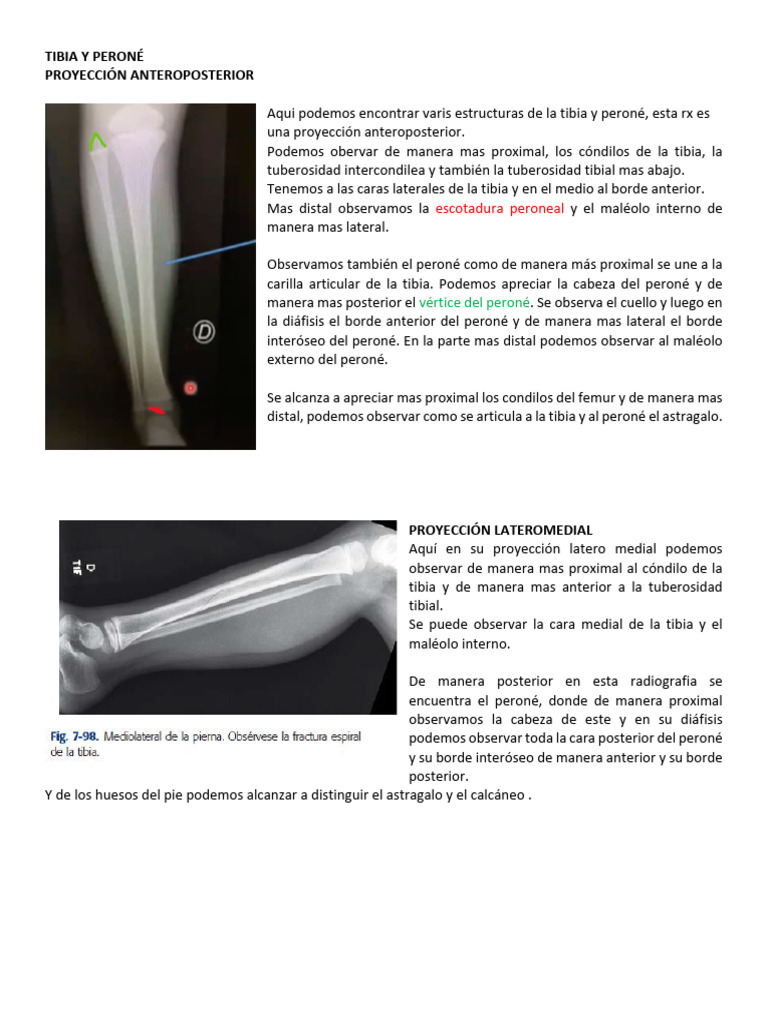 Tibia y Peroné | PDF | Pie | Anatomía humana