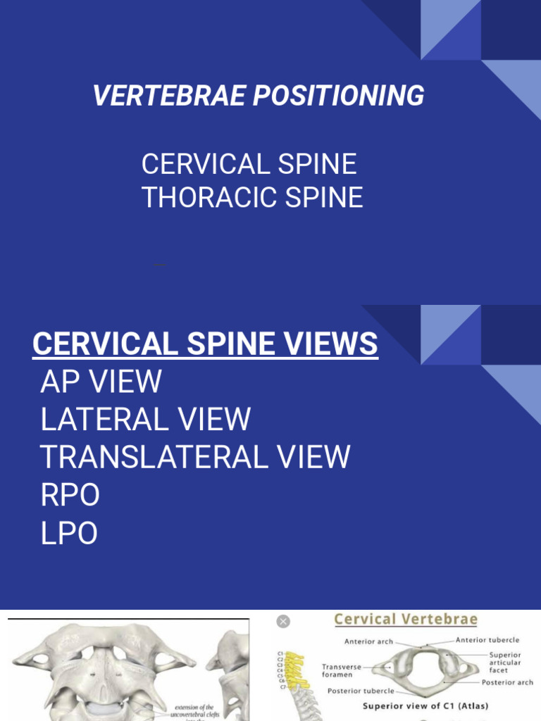 Cervical Spine X-Ray Positioning Guide | PDF | Vertebral Column ...
