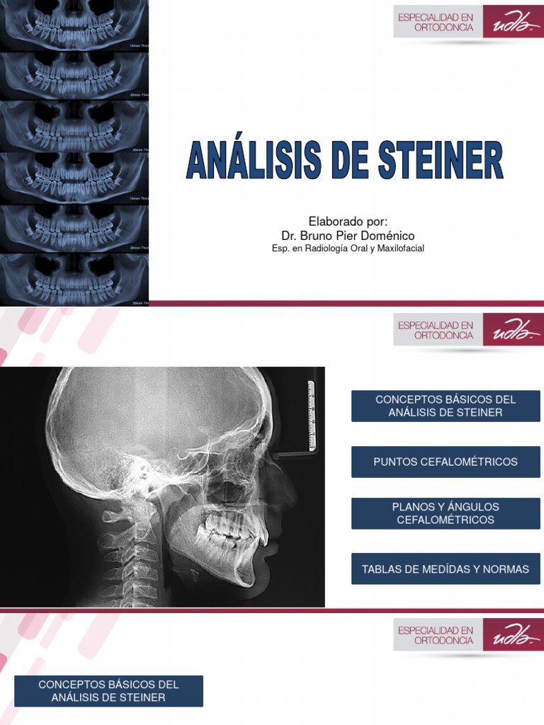 1.1. - Analisis de Steiner | PDF | Cráneo | Anatomía humana