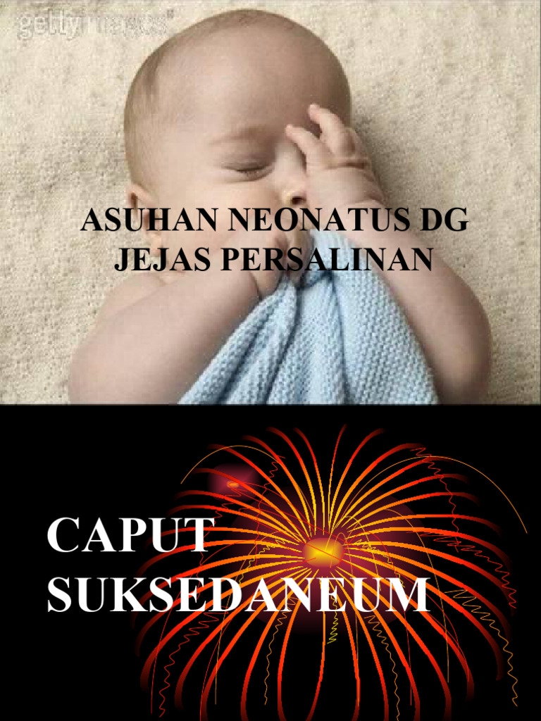 Asneo DG Jejas Persalinan | PDF