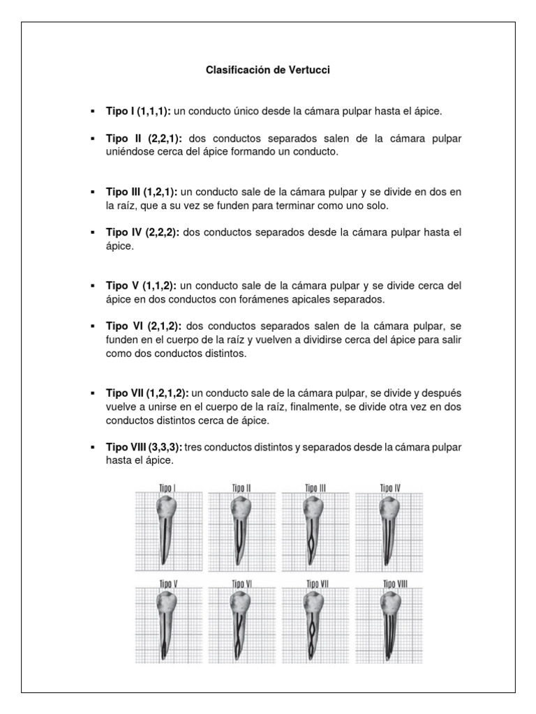 Clasificación de Vertucci | PDF | Arte