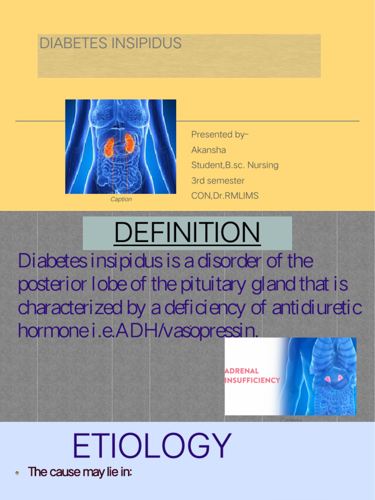 Diabetes Insipidus: Presented By-Akansha Student, B.sc. Nursing 3rd ...