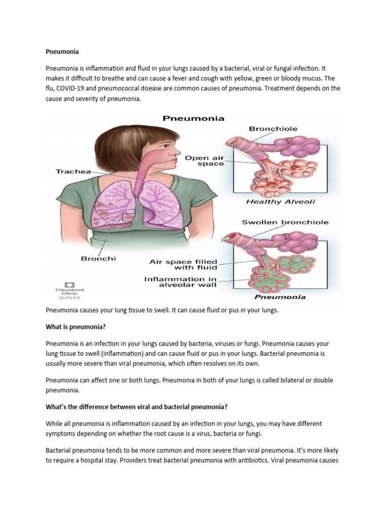 Pneumonia | PDF | Pneumonia | Respiratory Diseases