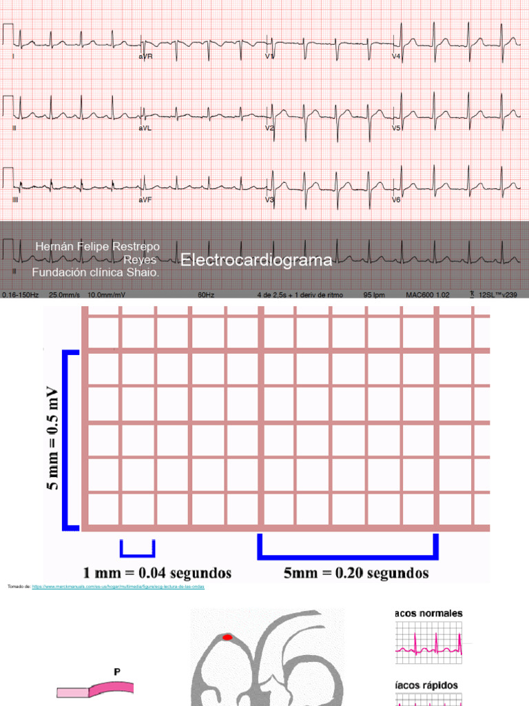 Electrocardiograma | PDF | Electrocardiografia | Fisiología