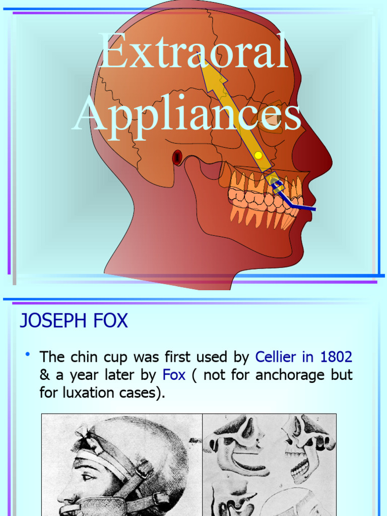 Extraoral Appliance | Download Free PDF | Orthodontics | Human Anatomy