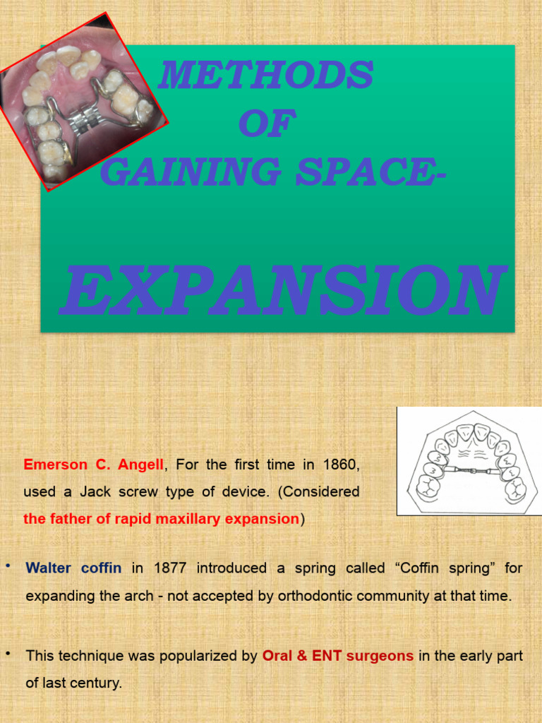 EXPANSION Method of Gaining Space | PDF | Orthodontics | Dentistry Branches EXPANSION Method of Gaining Space | PDF | Orthodontics | Dentistry Branches