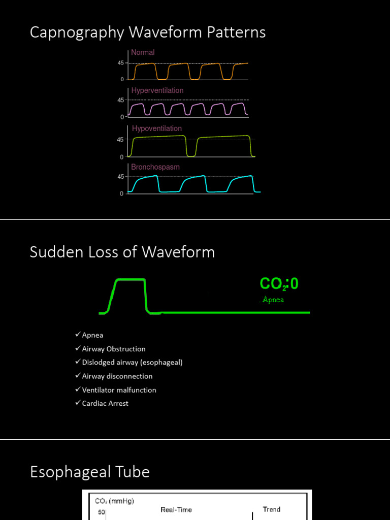 Capnography Waveform Patterns | PDF