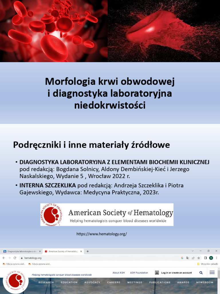 Morfologia Krwi Obwodowej I Diagnostyka Niedokrwistości 2023 | PDF Morfologia Krwi Obwodowej I Diagnostyka Niedokrwistości 2023 | PDF