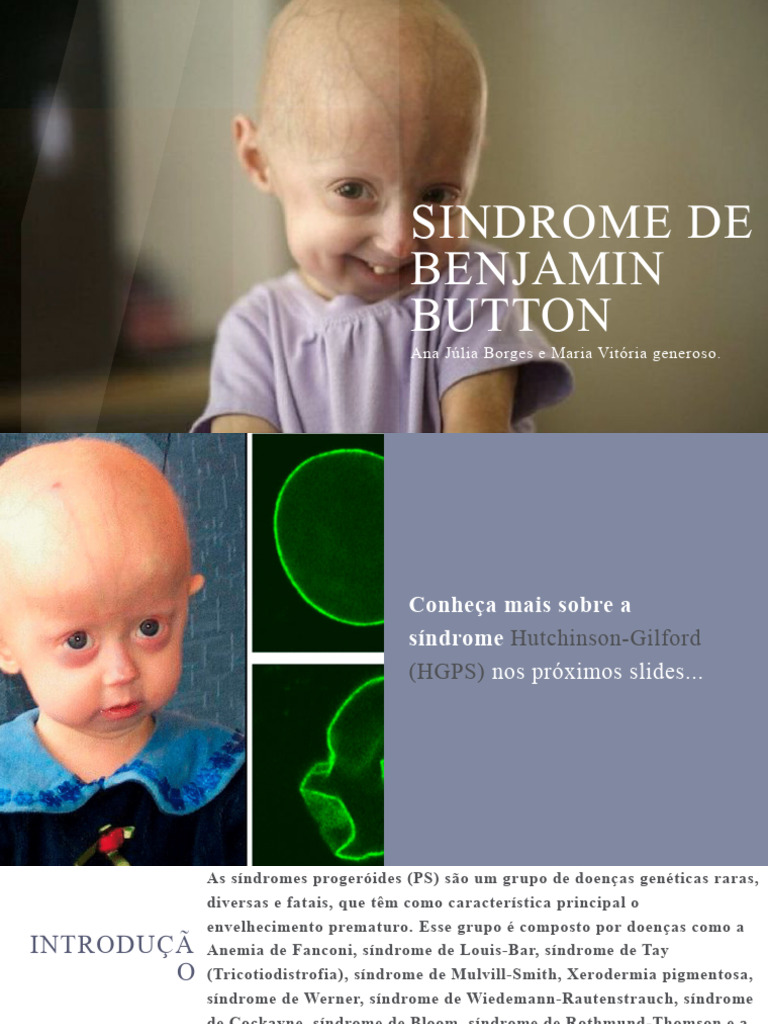 Sindrome de Benjamin Button | PDF | Especialidades médicas | Remédio