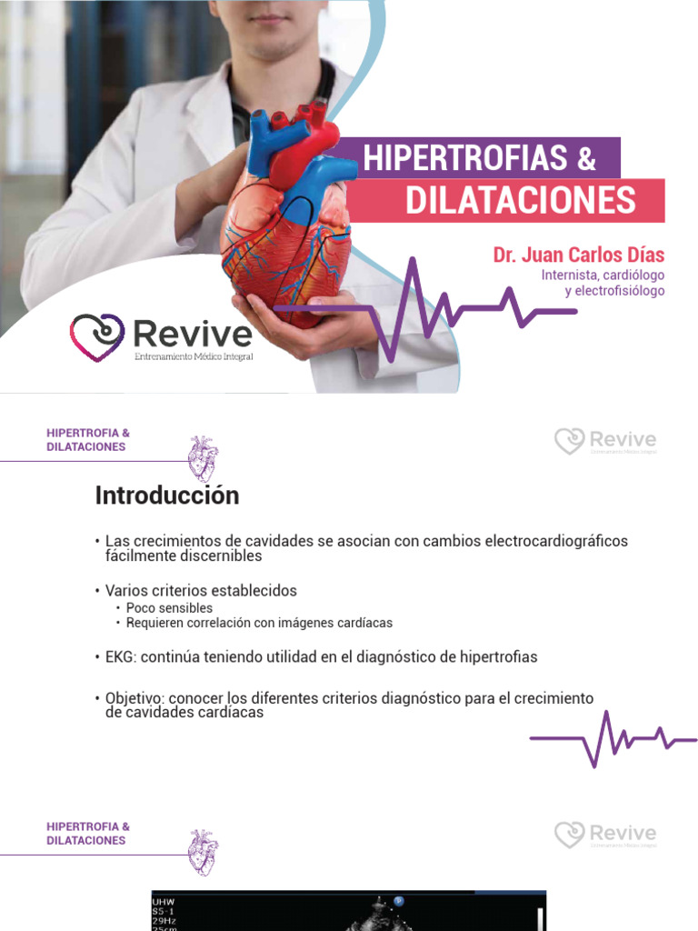 Criterios de Hipertrofia Cardíaca | PDF | Electrocardiografia | Sistema ...