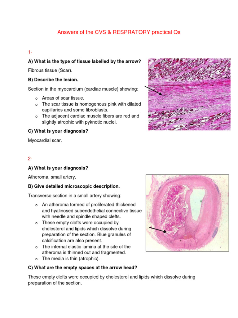Practical Pathology | PDF | Heart Valve | Lymphatic System