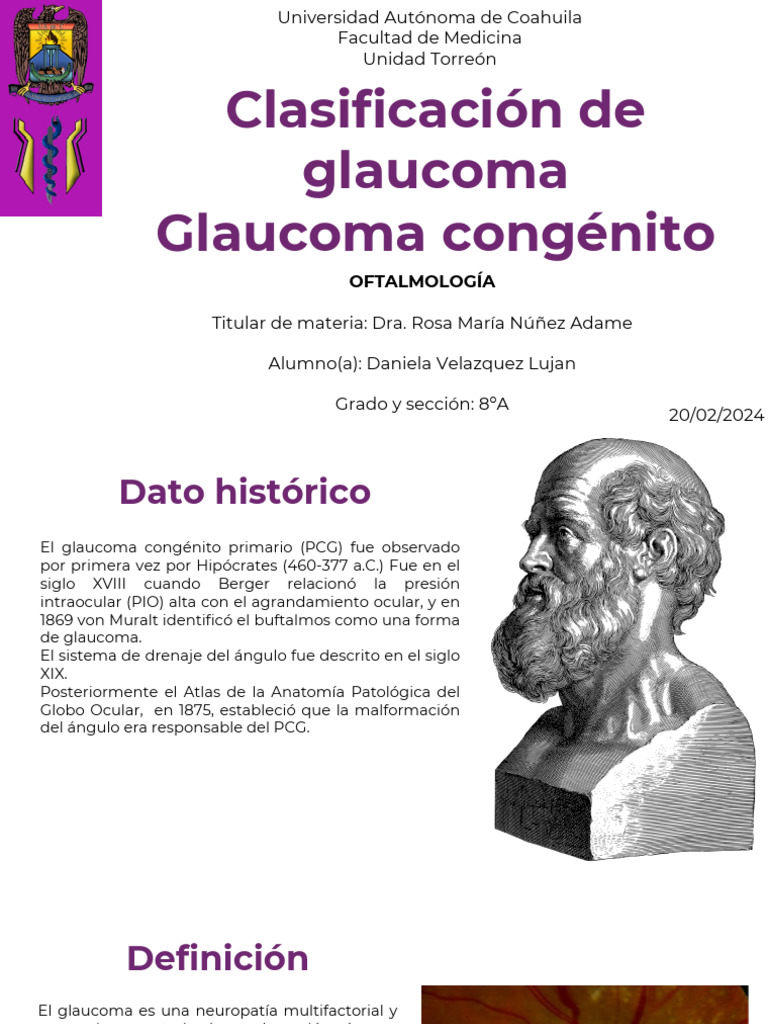 Glaucoma Congénito-1 | PDF | Glaucoma | Córnea