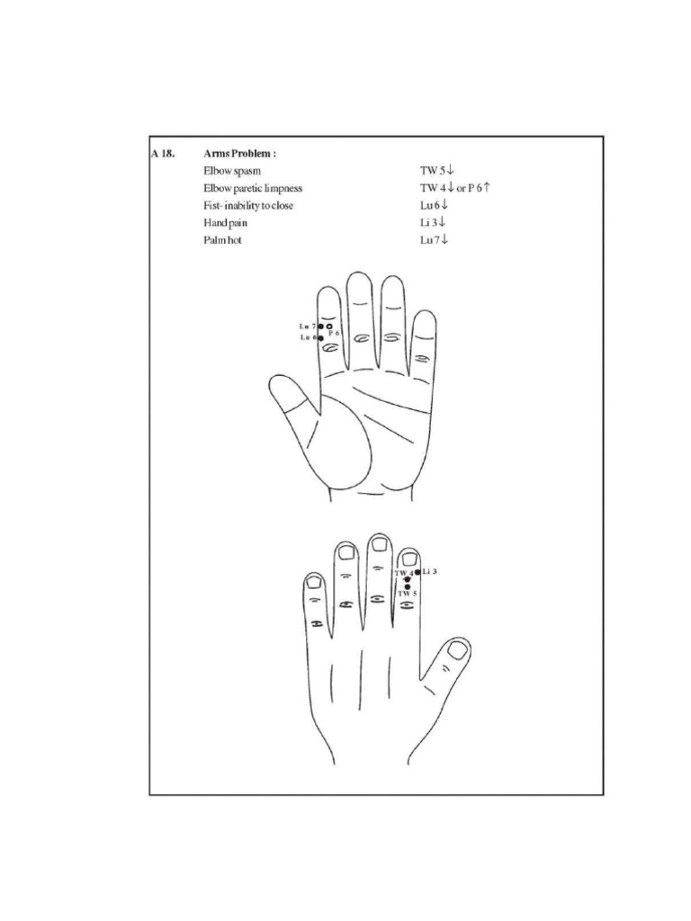 Hands Problems | PDF