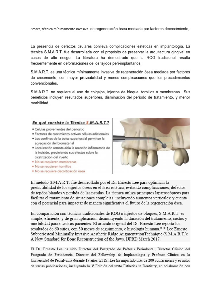 Tecnica SMART | PDF | Cepillo de dientes | Diente