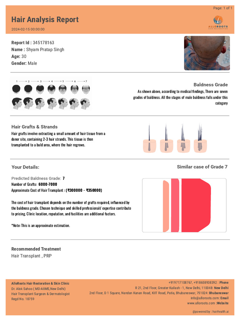 HairAnalyisReport 345178163 | PDF | Hair Loss | Organ Transplantation