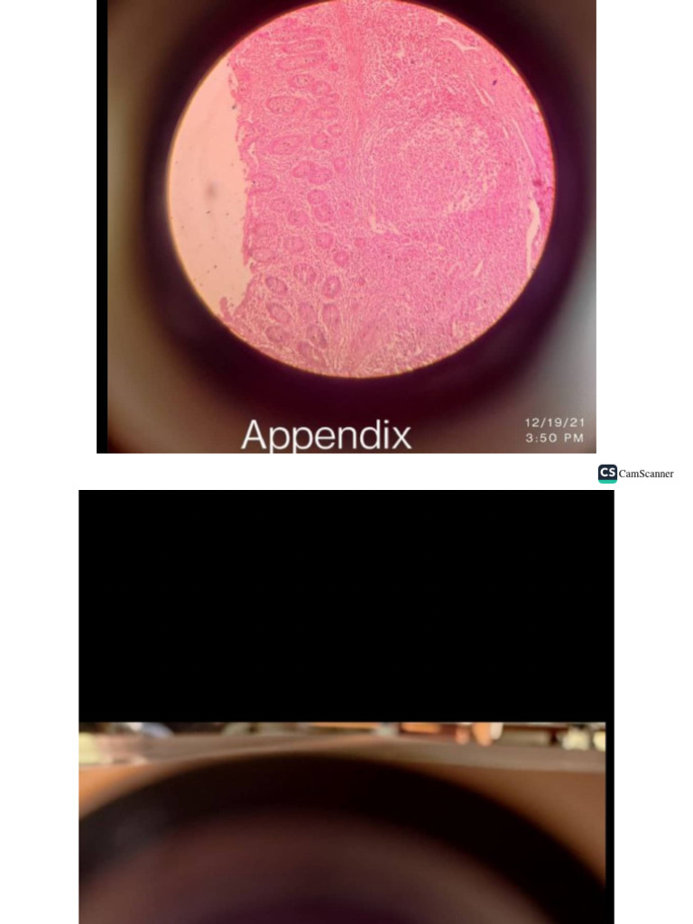 Histo Gi+endo+renal+hepato | PDF