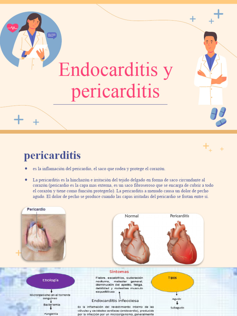 Endocarditis y Pericarditis | PDF