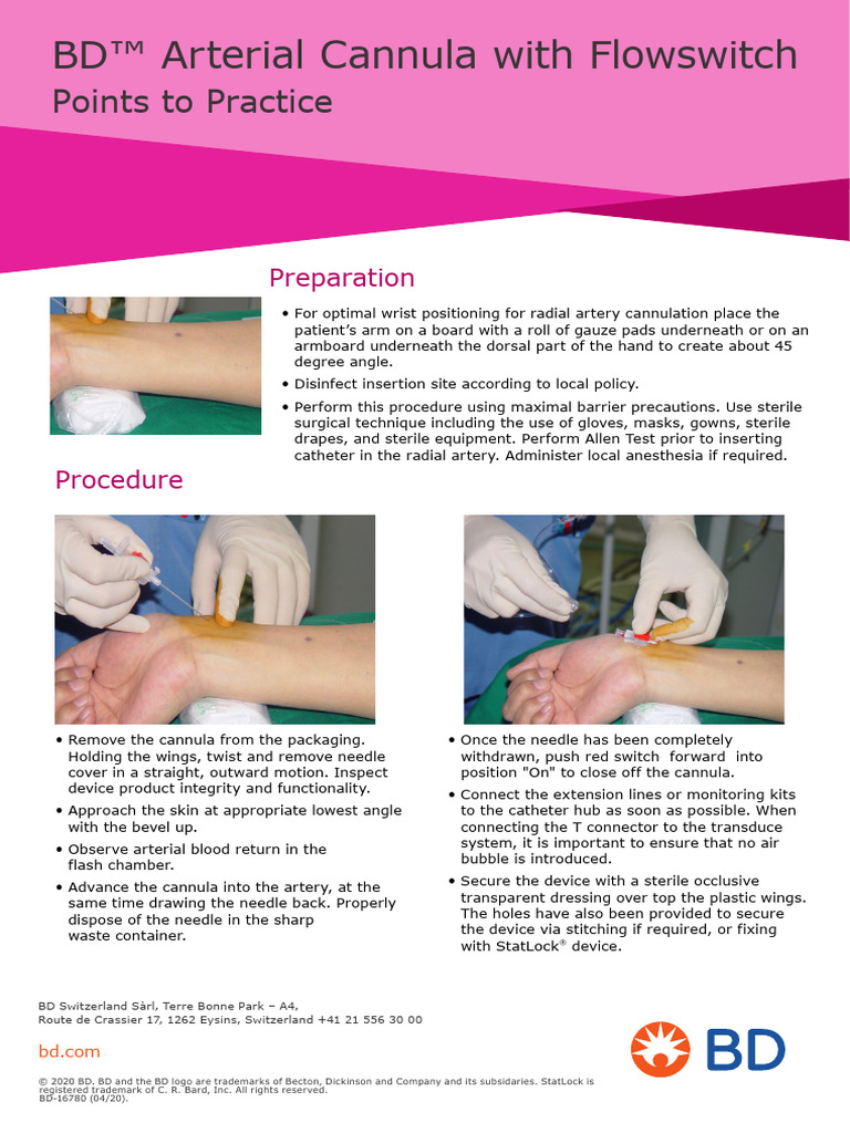 BD™ Arterial Cannula With Flowswitch: Points To Practice | PDF ...