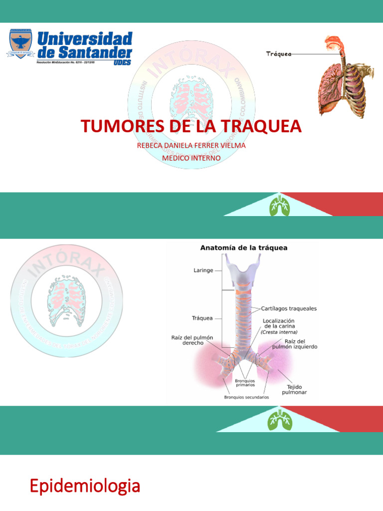 Tumores de La Traquea | PDF | Cáncer | Medicina