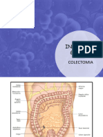 Sigmoidectomía Laparoscópica: Técnica y Equipo | PDF | Intestino grueso ...
