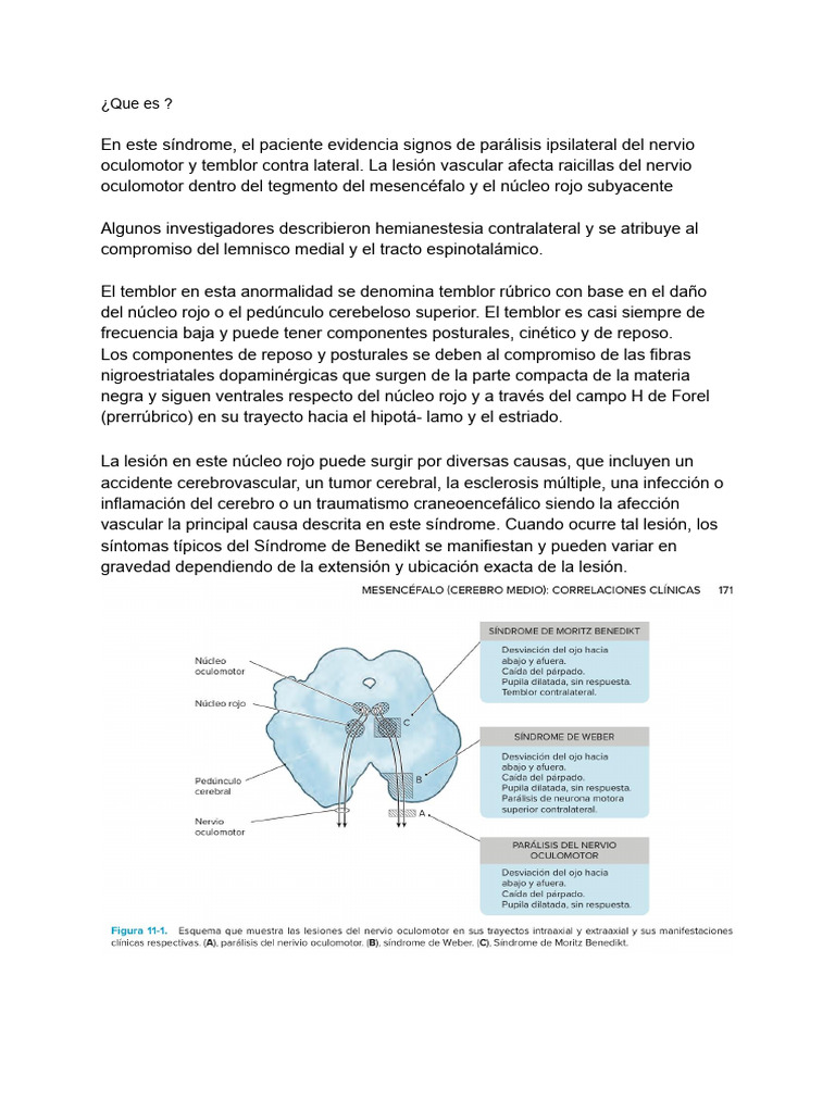 Síndrome de Benedikt: síntomas y tratamiento | PDF | Cerebelo ...