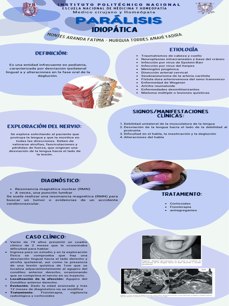 Parálisis Idiopática | PDF | Enfermedades y trastornos | Ciencias de la Salud