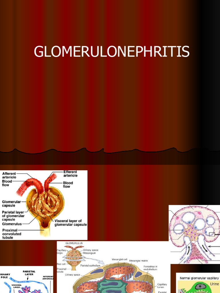 Glomerulonephritis | PDF | Clinical Medicine | Urinary System