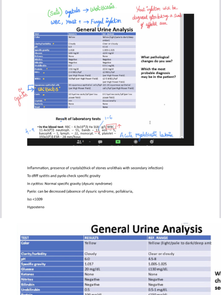 Urine Analysis | PDF