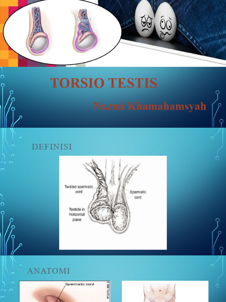 Torsio Testis-Dr. Nazmi Khamahamsyah-5 | PDF