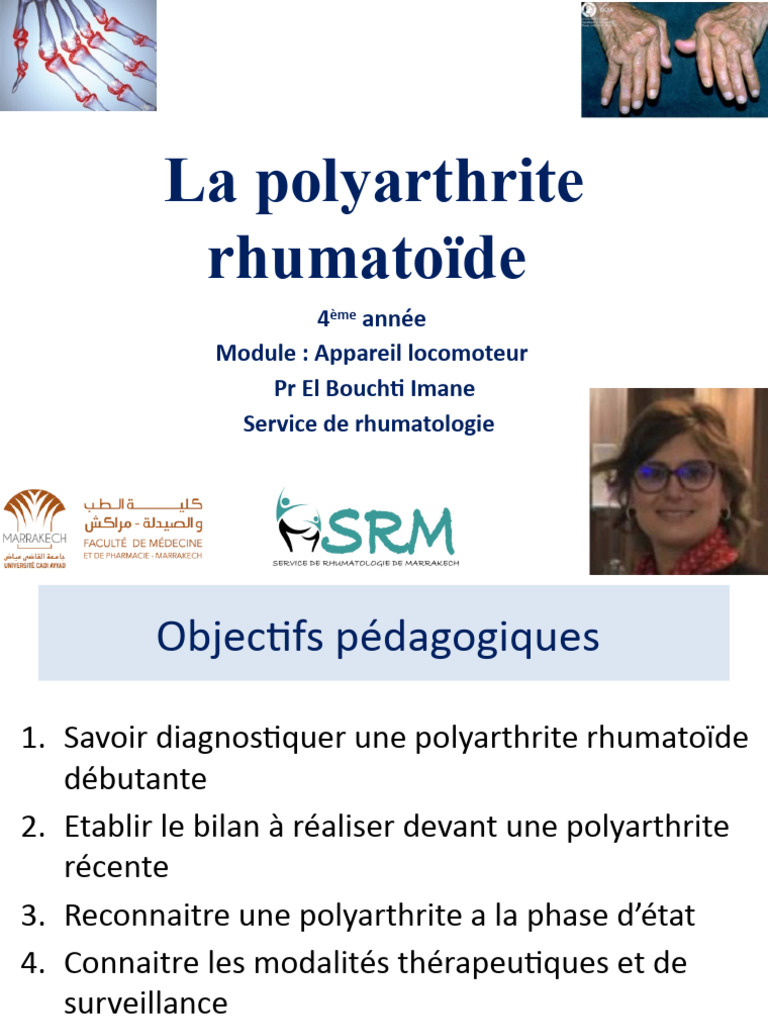 Diagnostic et traitement de la PR | PDF | Polyarthrite rhumatoïde | Pied