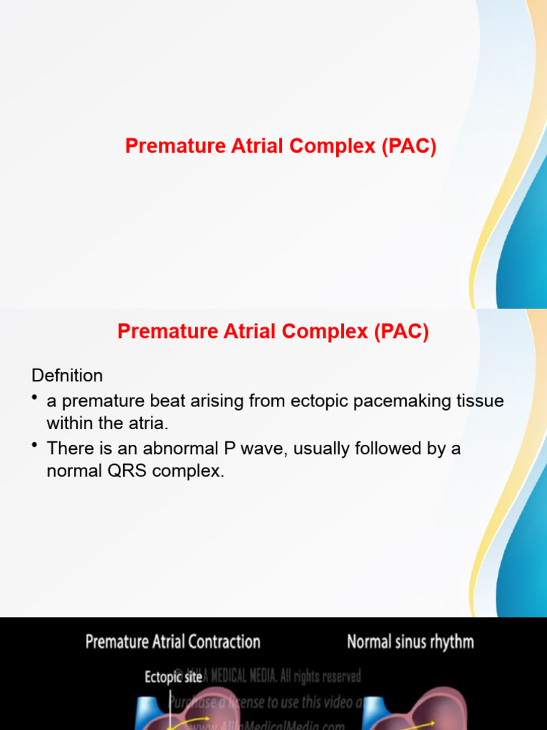 Premature - Atrial - Complex Final | PDF | Science & Mathematics