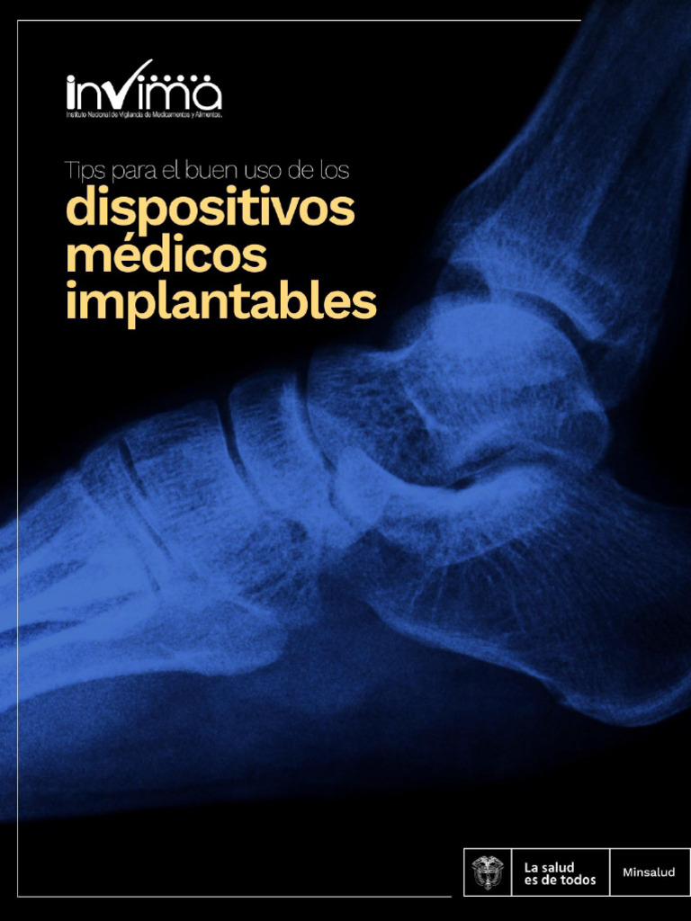 Dispositivos Medicos Implantables | PDF