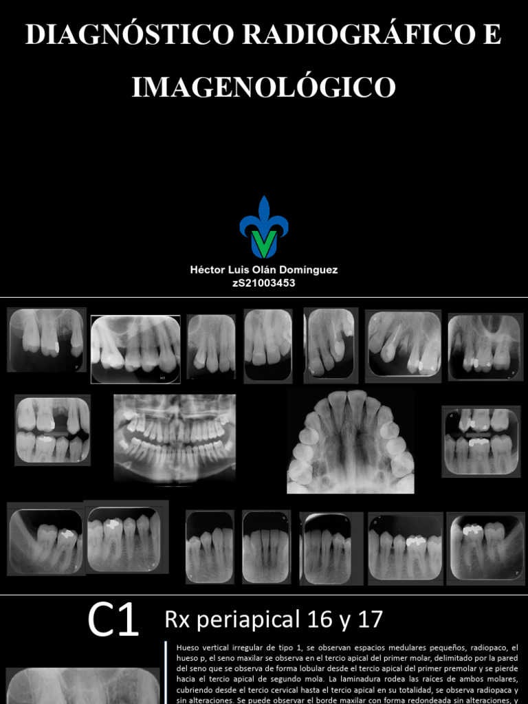 Informe de Radiografías Periapicales | PDF | Anatomia dental | Ramas de ...