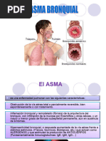 Fisiopatología del Asma Bronquial | PDF | Asma | Alergia