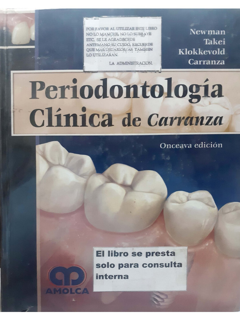 Capítulo 7. Periodontología Clínica de Carranza. 11. Ed | PDF