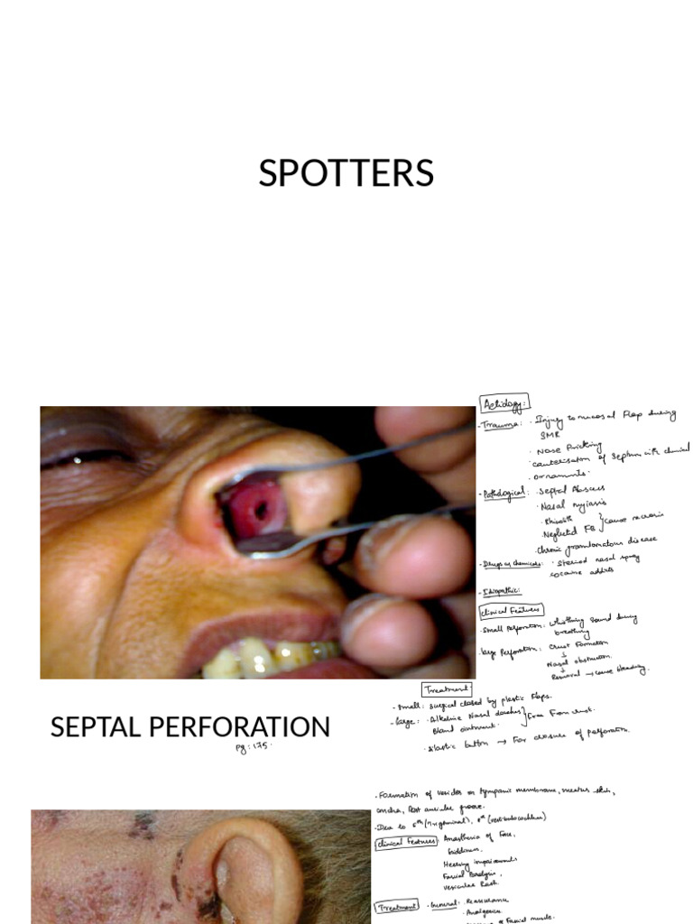 Ent Spotters | PDF