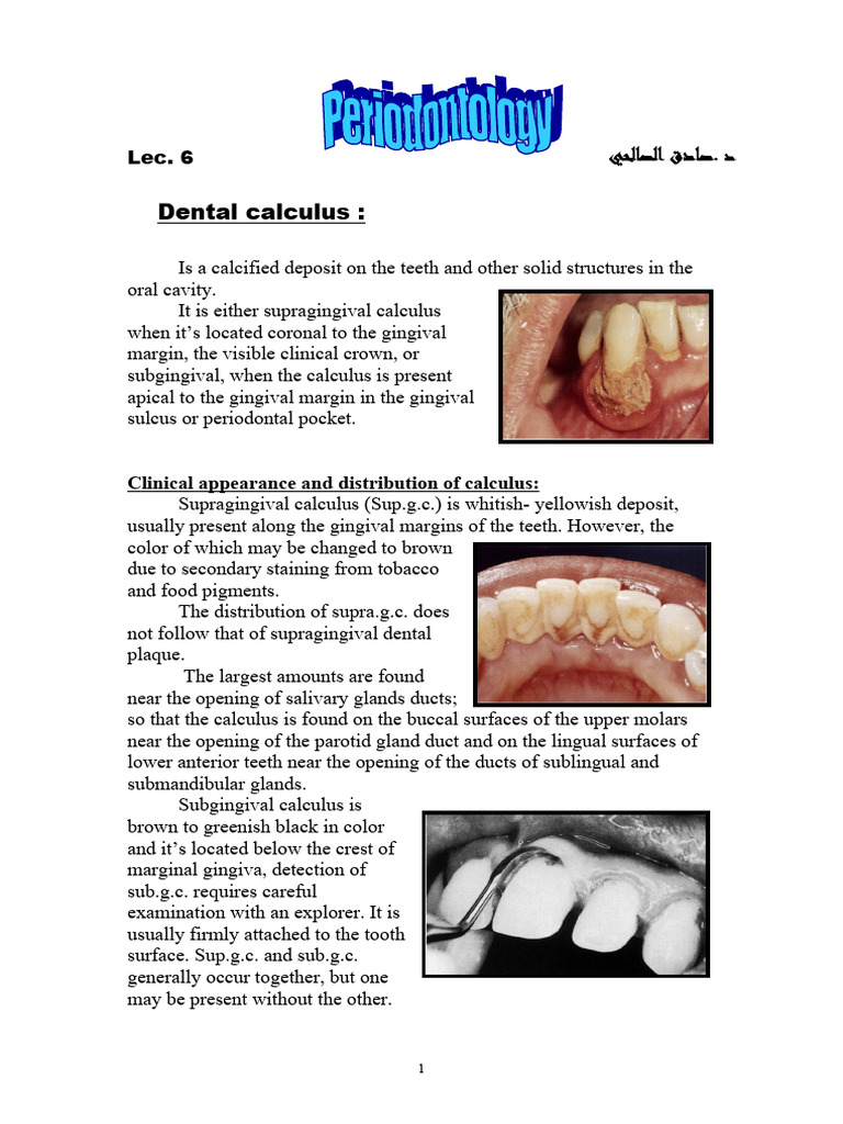 Dental Calculus | PDF | Mouth