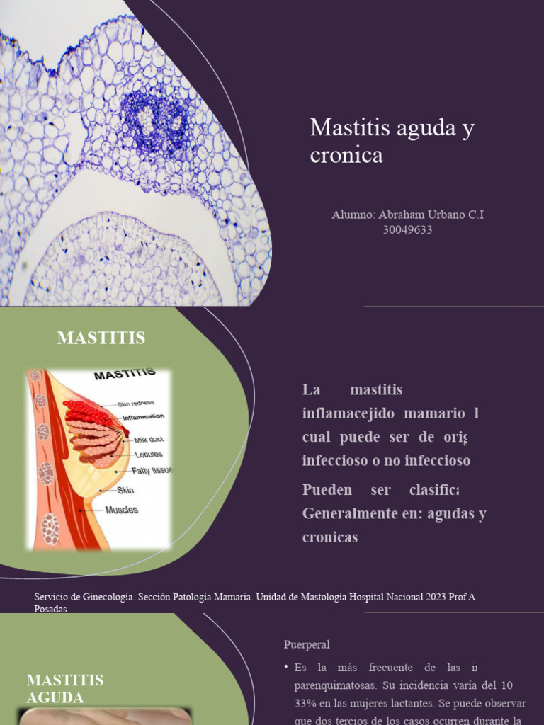 Tipos y Tratamientos de Mastitis | PDF | Medicina | Causas de la muerte
