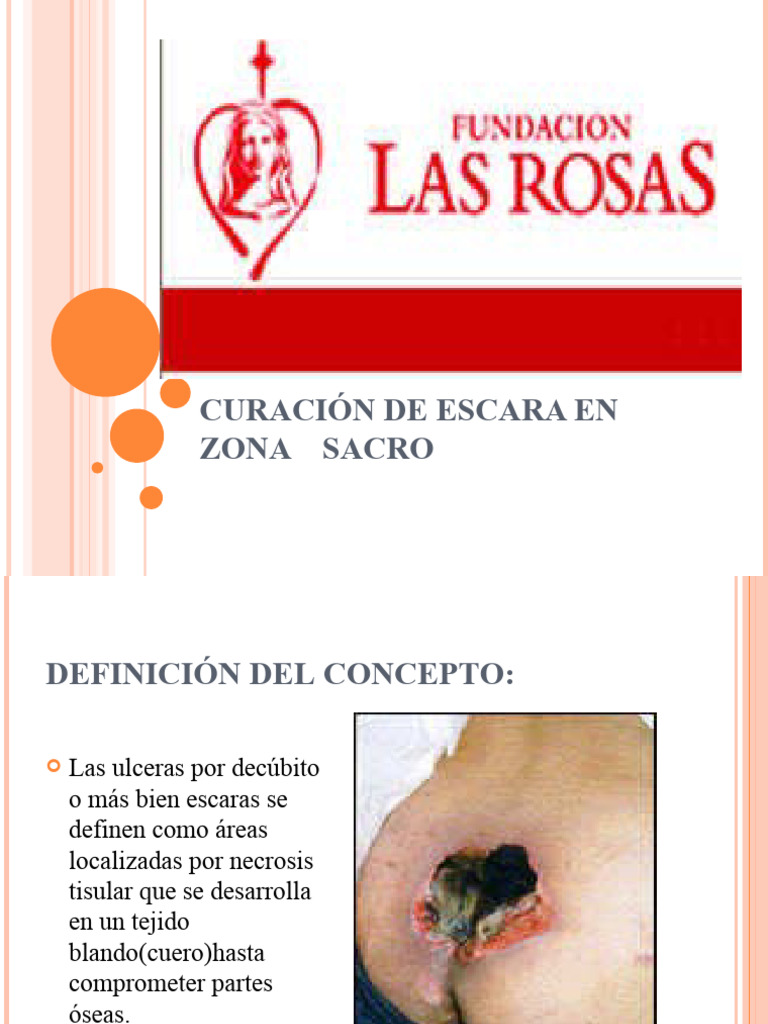 Curación de Escara en Zona Sacro | PDF | Herida | Piel