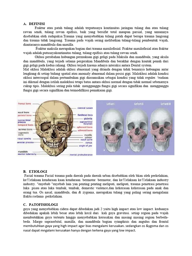 Fraktur Mandibula dan Maksila: Penanganan | PDF | Sains & Matematika