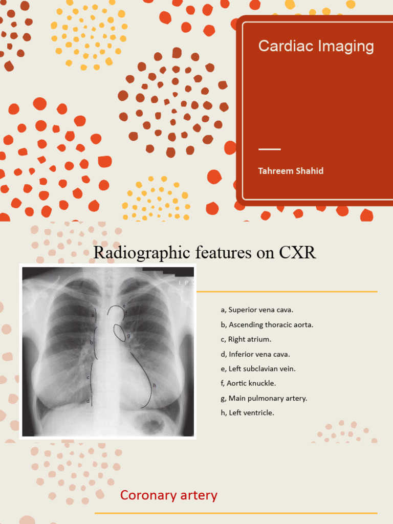 Cardiac Imaging-Anatomy | PDF | Coronary Circulation | Heart