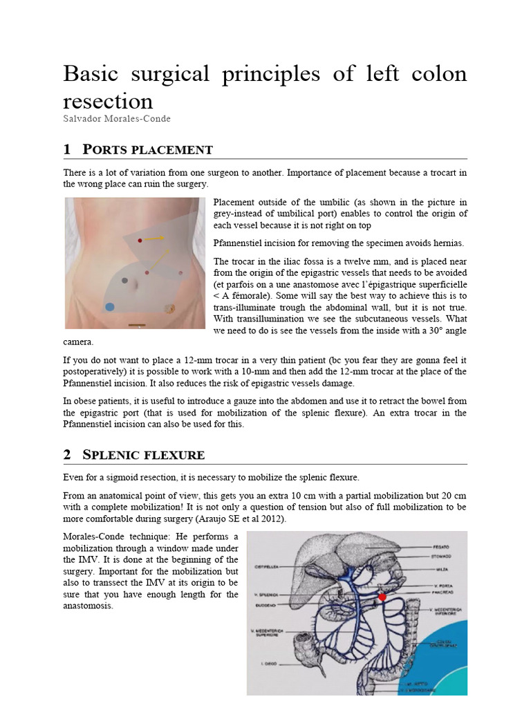Basic Surgical Principles of Left Colon Resection | PDF | Surgery | Medical Specialties