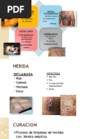 Regla de los 9 de Wallace en quemaduras | PDF | Ciencias sociales