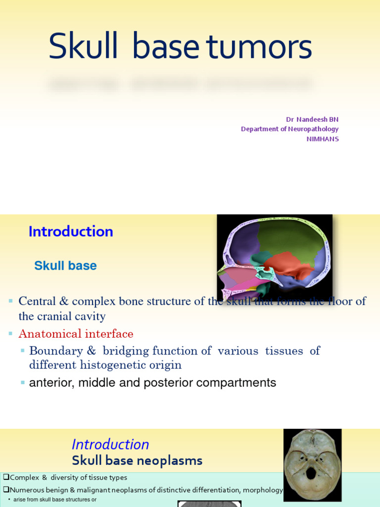 Skull Base Tumors NBN | PDF | Neoplasms | Skull